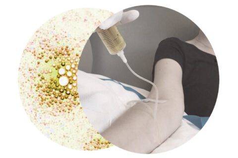 ONOGEN | IV Therapies and Injections